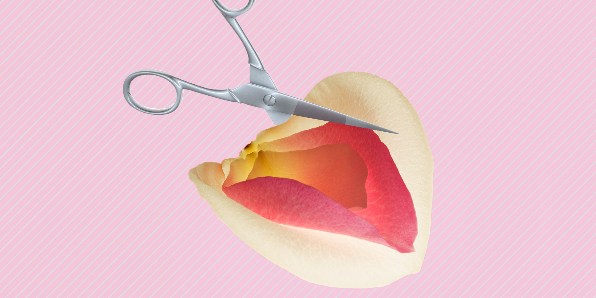 Do I Need Labia Surgery Do I Need Labia Surgery