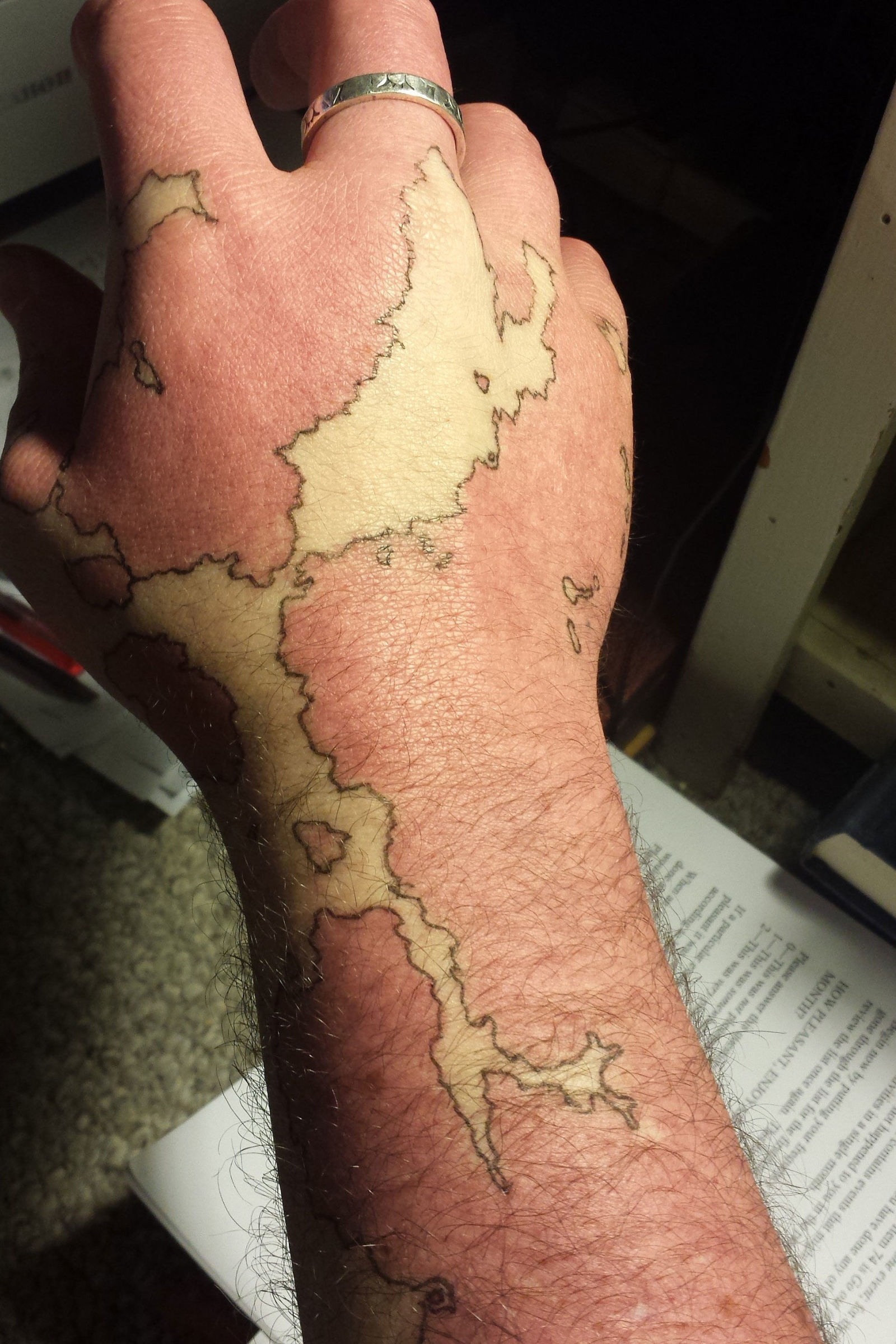 This Man Transformed His Unique Birthmarks Into an Imaginary Map of the ...