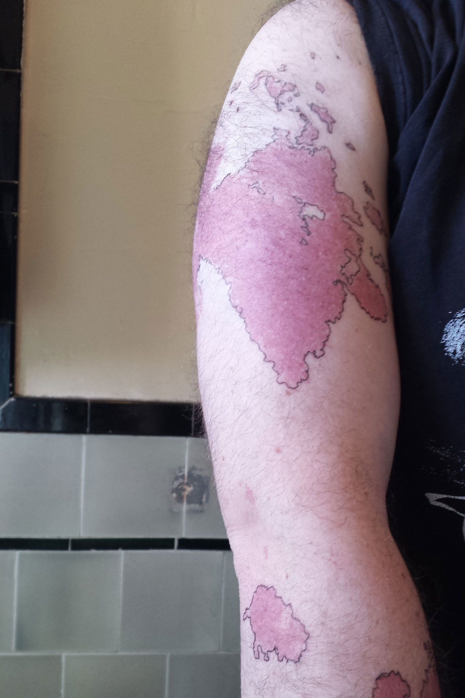 This Man Transformed His Unique Birthmarks Into an Imaginary Map of the ...